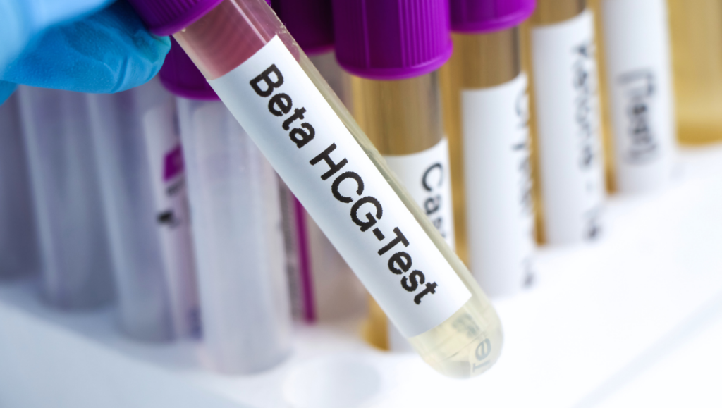 Resultado do exame de beta hCG: como interpretar os valores e o que ...